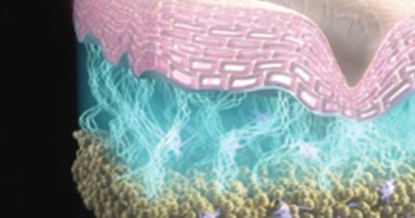 What is Collagen Filler Australia - Patients - Austramedex